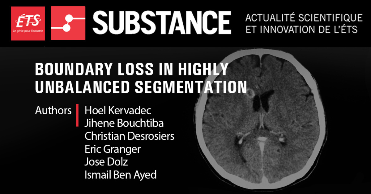Boundary Loss in Highly Unbalanced Segmentation - ÉTS Montréal