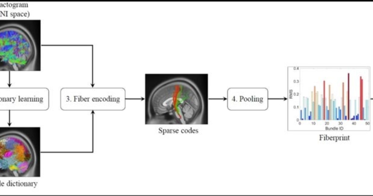 Fiberprint: Human Brain Wiring Shows Unique Fingerprint - ÉTS Montréal